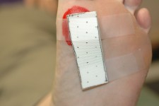 Morton's Toe| What is it, What Causes it, How to Treat it